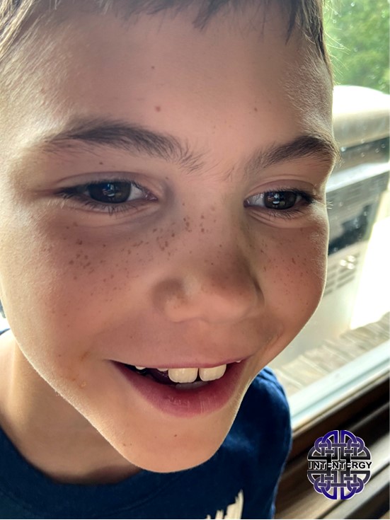 Sleeping Freckles | Intentergy